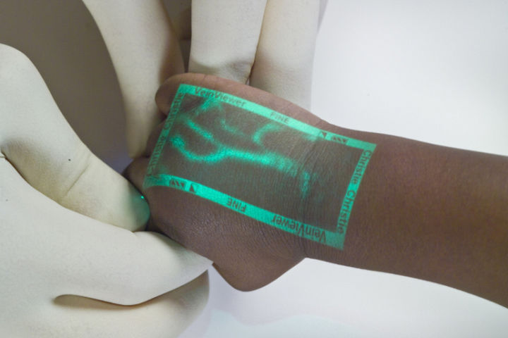 VeinViewer Allows Clinicians to See Your Veins in Real-Time